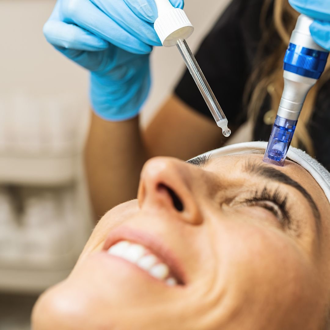 What Are The Benefits Of Nano Needling Compared To Other Facial ...
