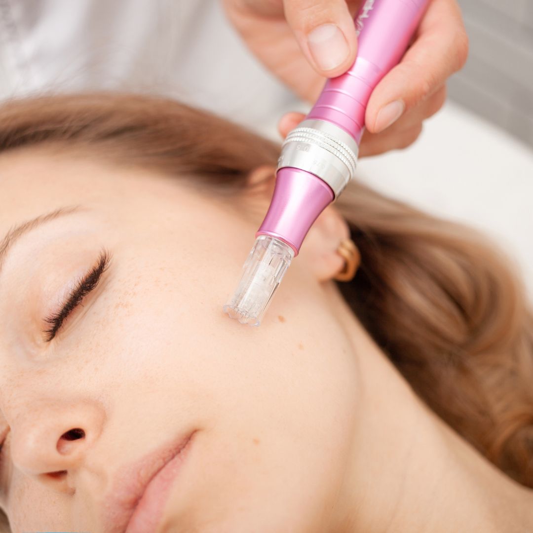 What Areas Of The Body Can Treat With Nano Needling? - Know the ...